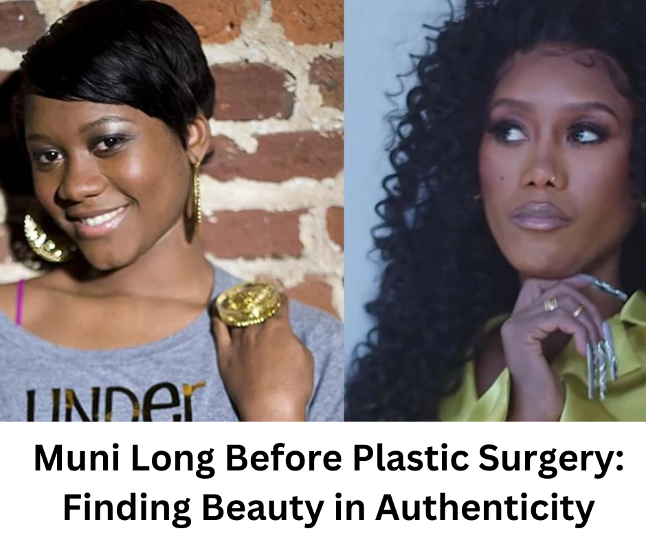 Muni Long Before Plastic Surgery: Finding Beauty in Authenticity ...