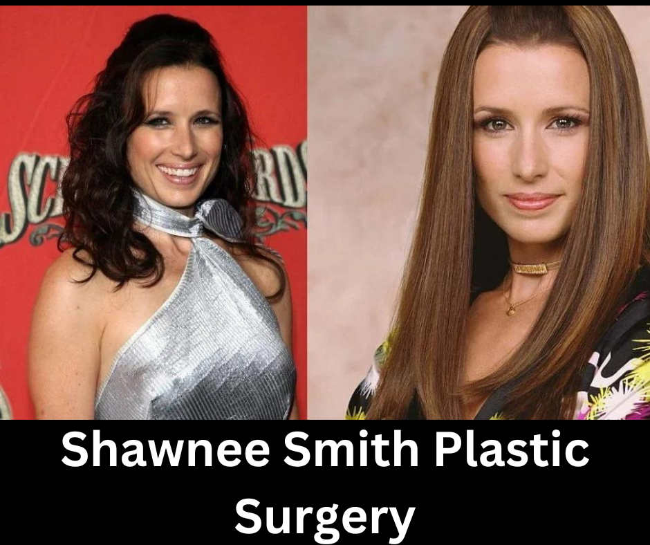Shawnee Smith Plastic Surgery: The Truth Behind the Transformation ...