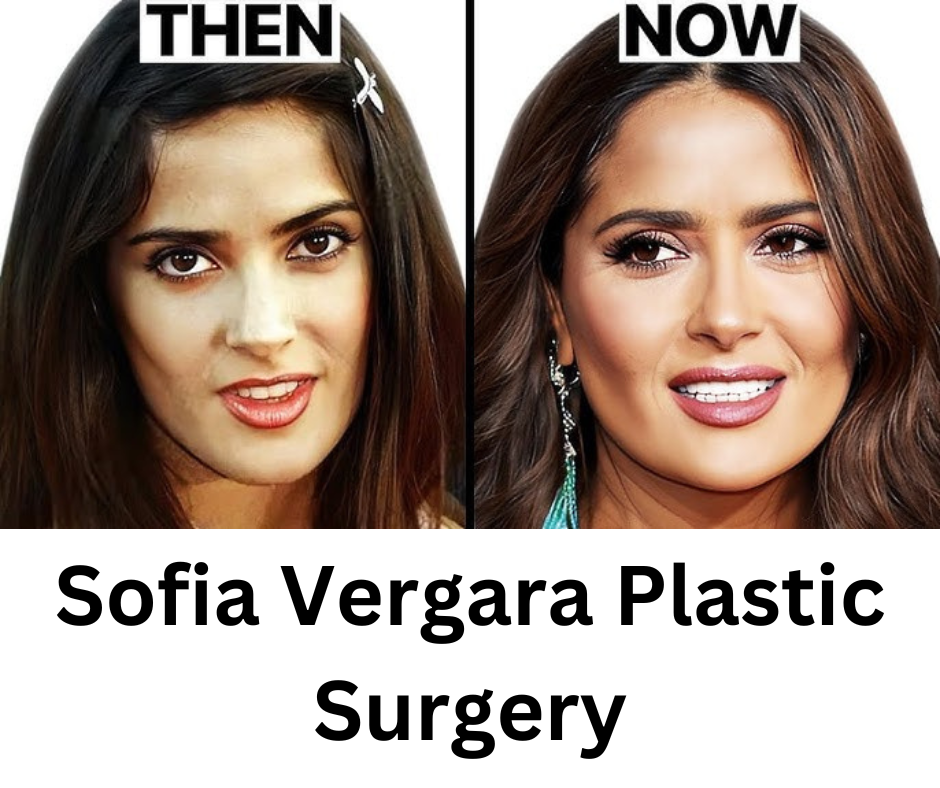 Sofia Vergara Plastic Surgery - Celebrity Plastic Surgery