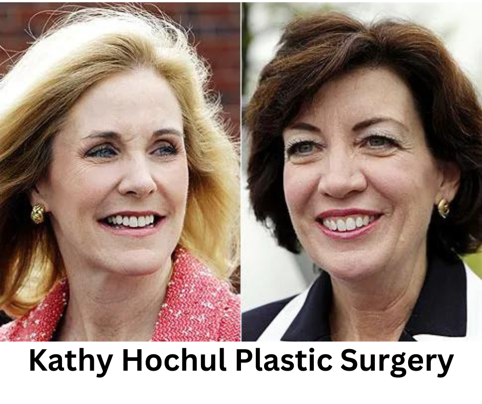 Kathy Hochul Plastic Surgery Rumors: An Honest Look at the New York ...