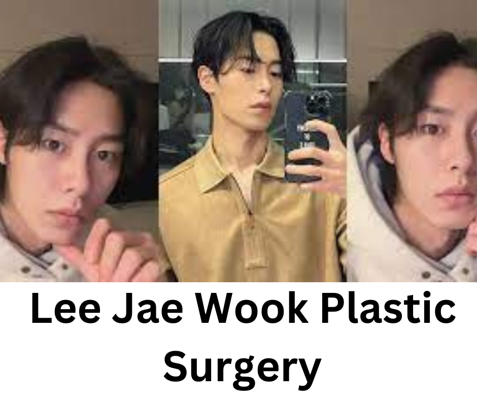 Lee Jae Wook Plastic Surgery The Truth Behind The Rumors Celebrity Plastic Surgery