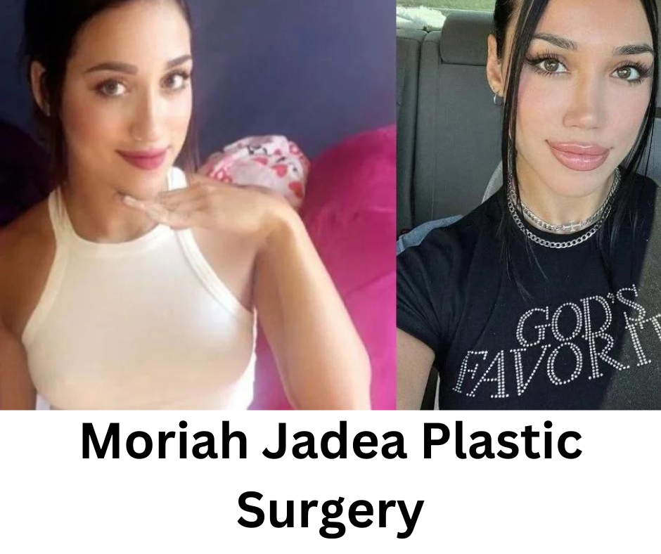 Moriah Jadea Plastic Surgery: A Candid Look at Her Plastic Surgery ...
