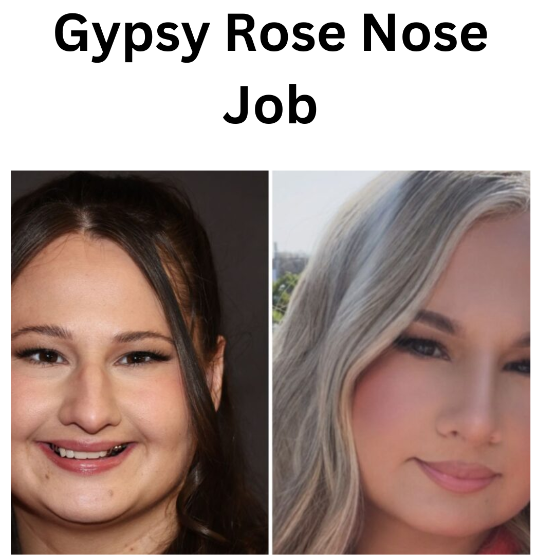 The Journey of Gypsy Rose Nose Job: A Comprehensive Look - Celebrity ...