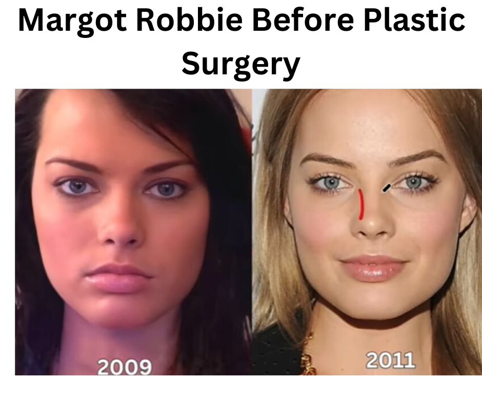 Margot Robbie Before Plastic Surgery: The Natural Beauty That Took ...