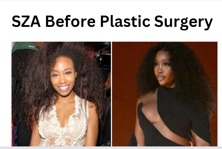 SZA Before Plastic Surgery: Evolving Artistry, Image, and the Impact of Fame - Celebrity Plastic ...